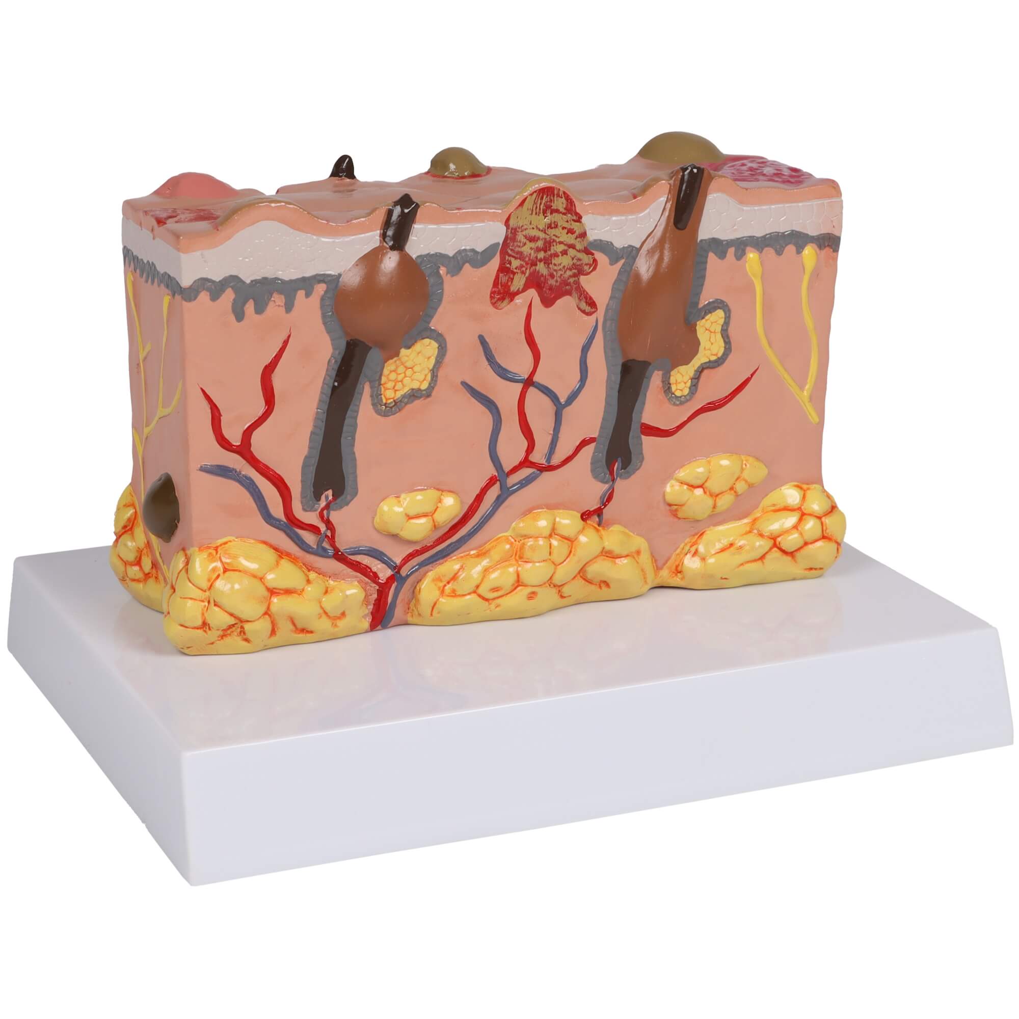 ERLER-ZIMMER | Hautmodell pathologisch (J755)