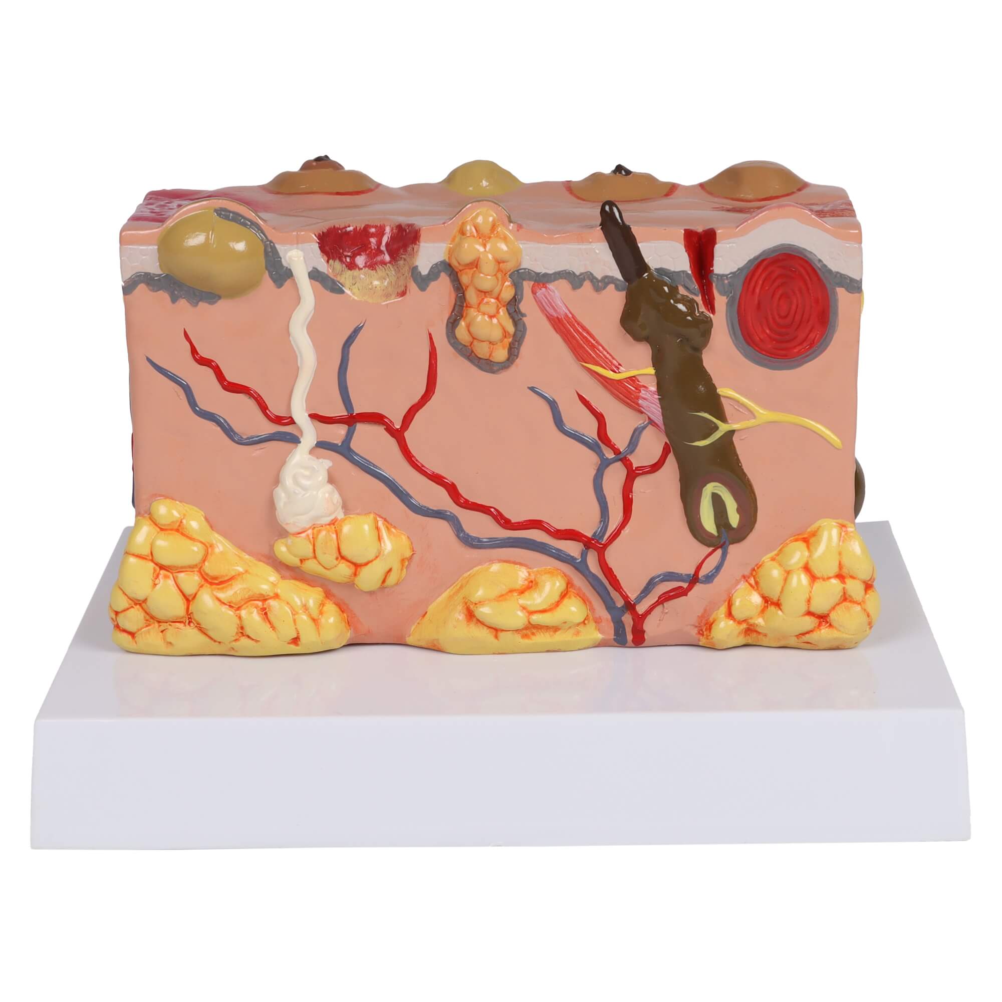 ERLER-ZIMMER | Hautmodell pathologisch (J755)