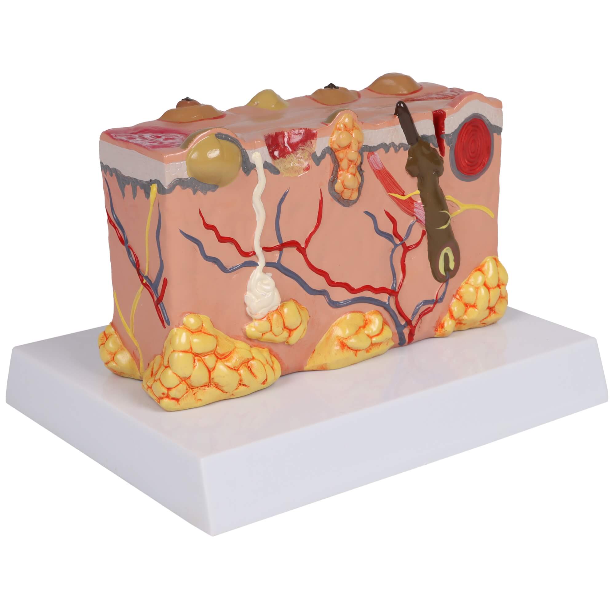 ERLER-ZIMMER | Hautmodell pathologisch (J755)