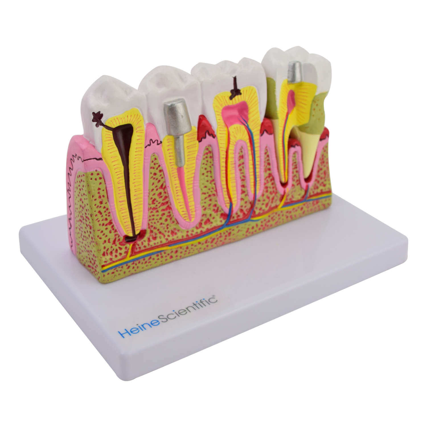 HeineScientific | Backenzähne (H139029)